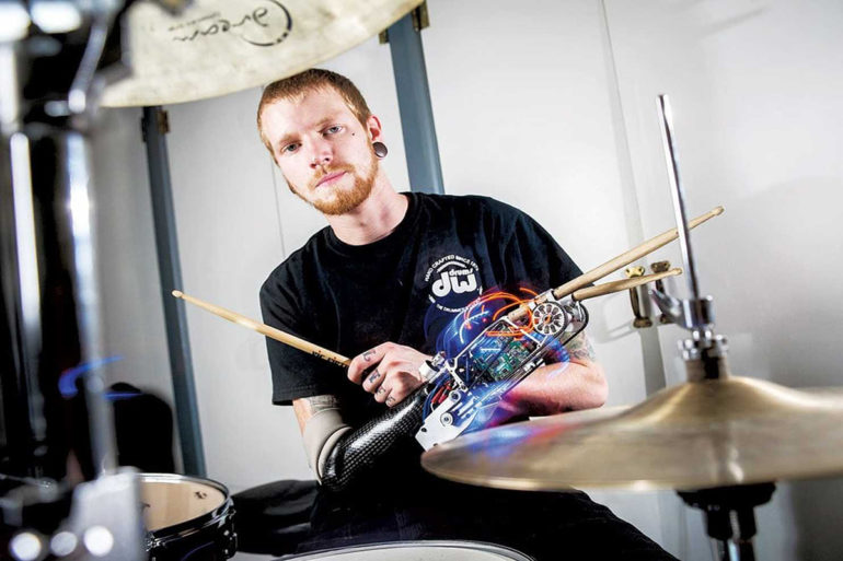 Jason Barnes, el primer baterista biónico del mundo Jason Barnes, el primer baterista biónico del mundo